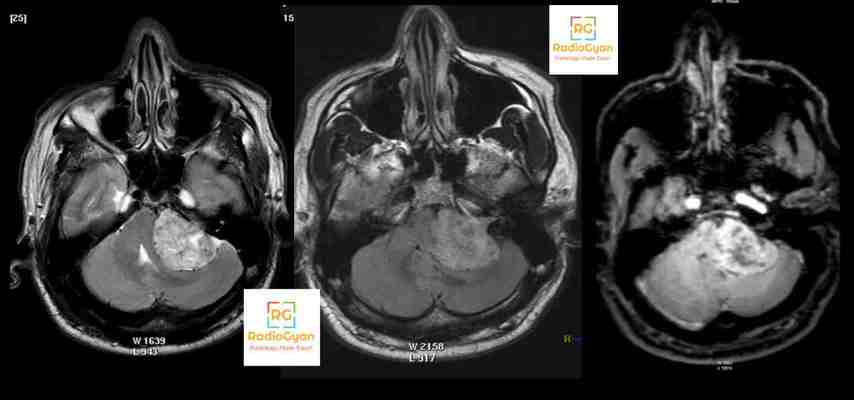 Radiology Spotters Set 12 Radiogyan
